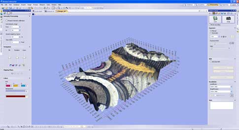 Olympus Stream v. 1.7 Microscope Image Analysis Software | Quality Digest