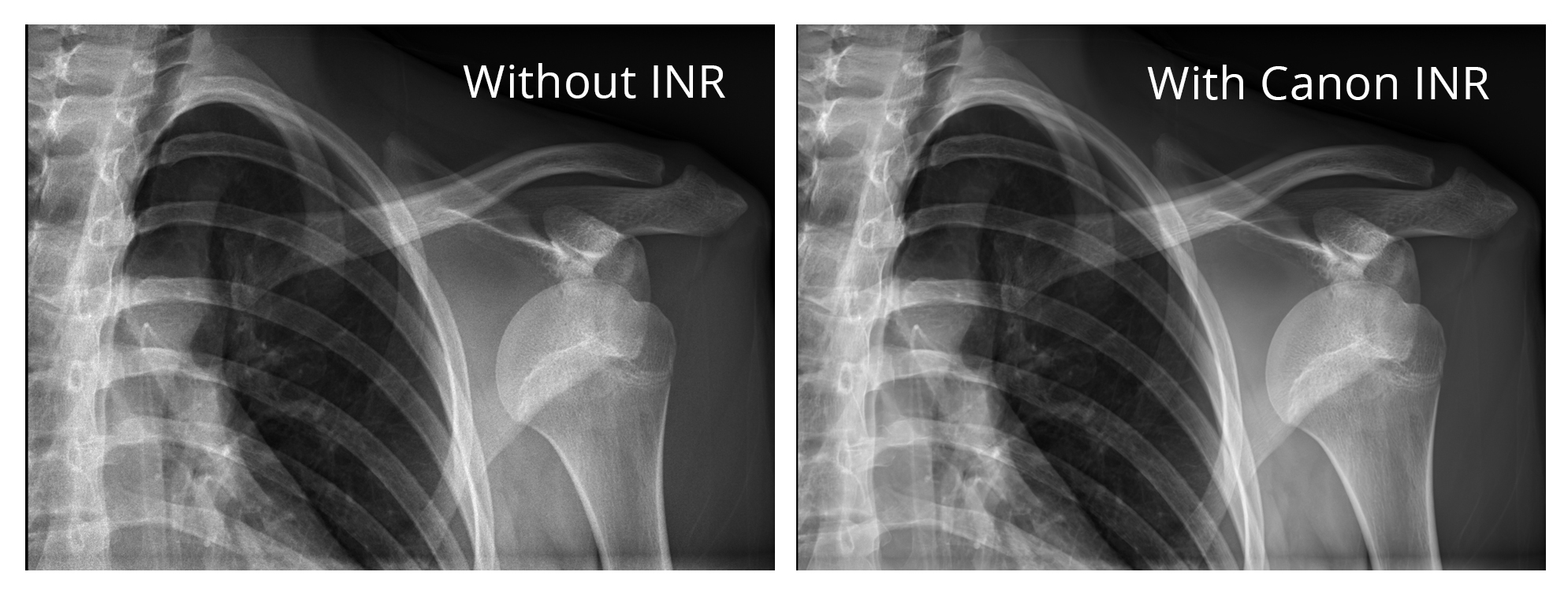 Canon Medical/Digital Radiography Releases Clinical White Paper ...