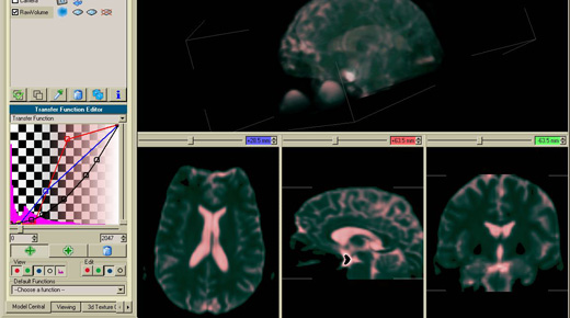 Understanding QMS Software Validation Requirements in ISO 13485:2016 ...