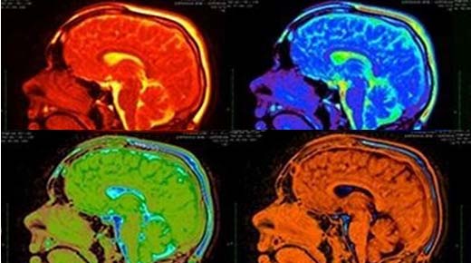 Four States of Mind, Part 2 | Quality Digest